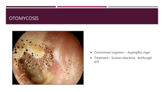 Diseases of external ear Dr Utkal Mishra | PPTX