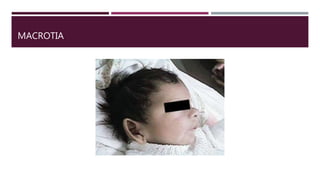 Diseases of external ear Dr Utkal Mishra | PPTX