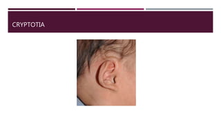 Diseases of external ear Dr Utkal Mishra | PPTX