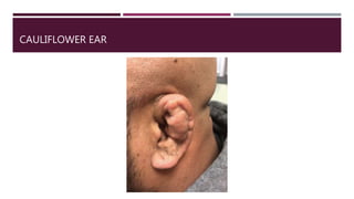 Diseases of external ear Dr Utkal Mishra | PPTX