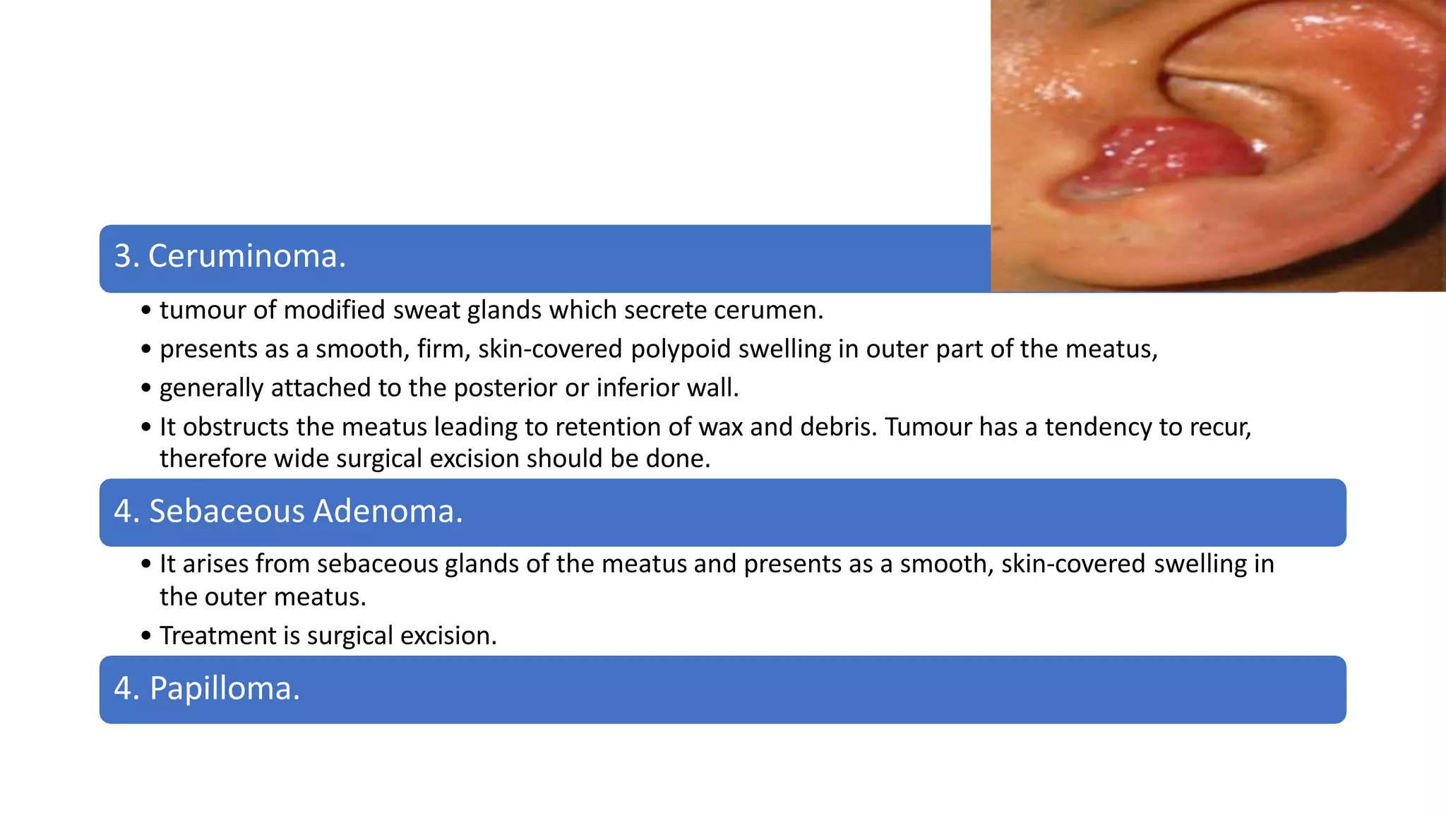 diseasesofexternalear | PPTX