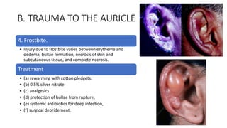 diseasesofexternalear | PPT