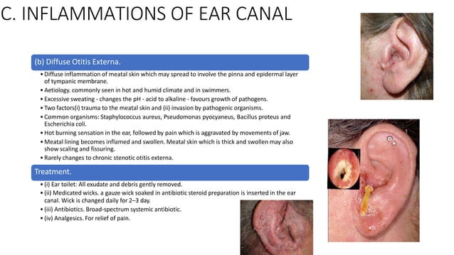 diseasesofexternalear | PPT