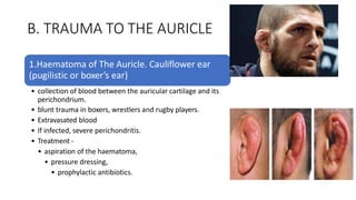 diseasesofexternalear | PPT