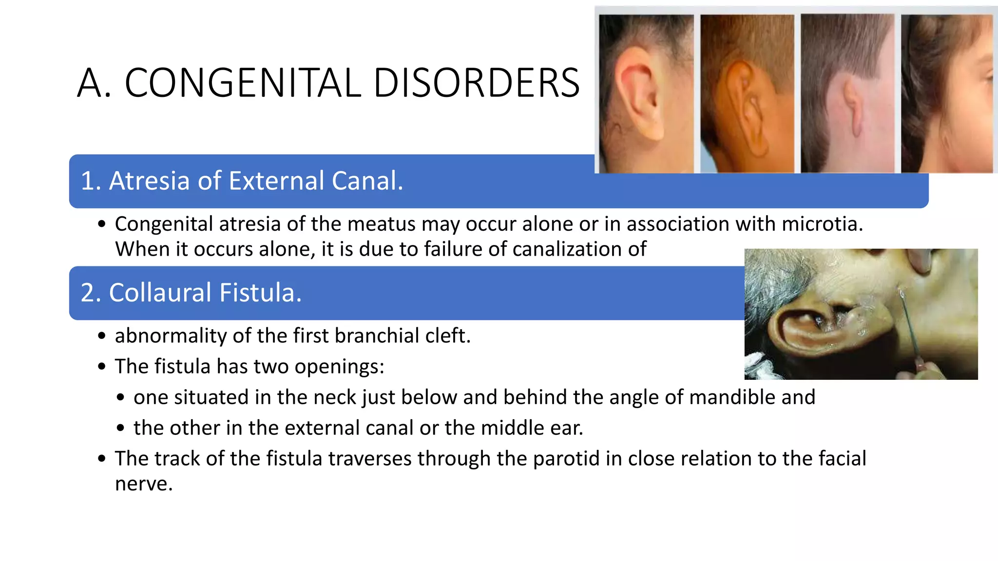 Diseases of External Ear.pptx