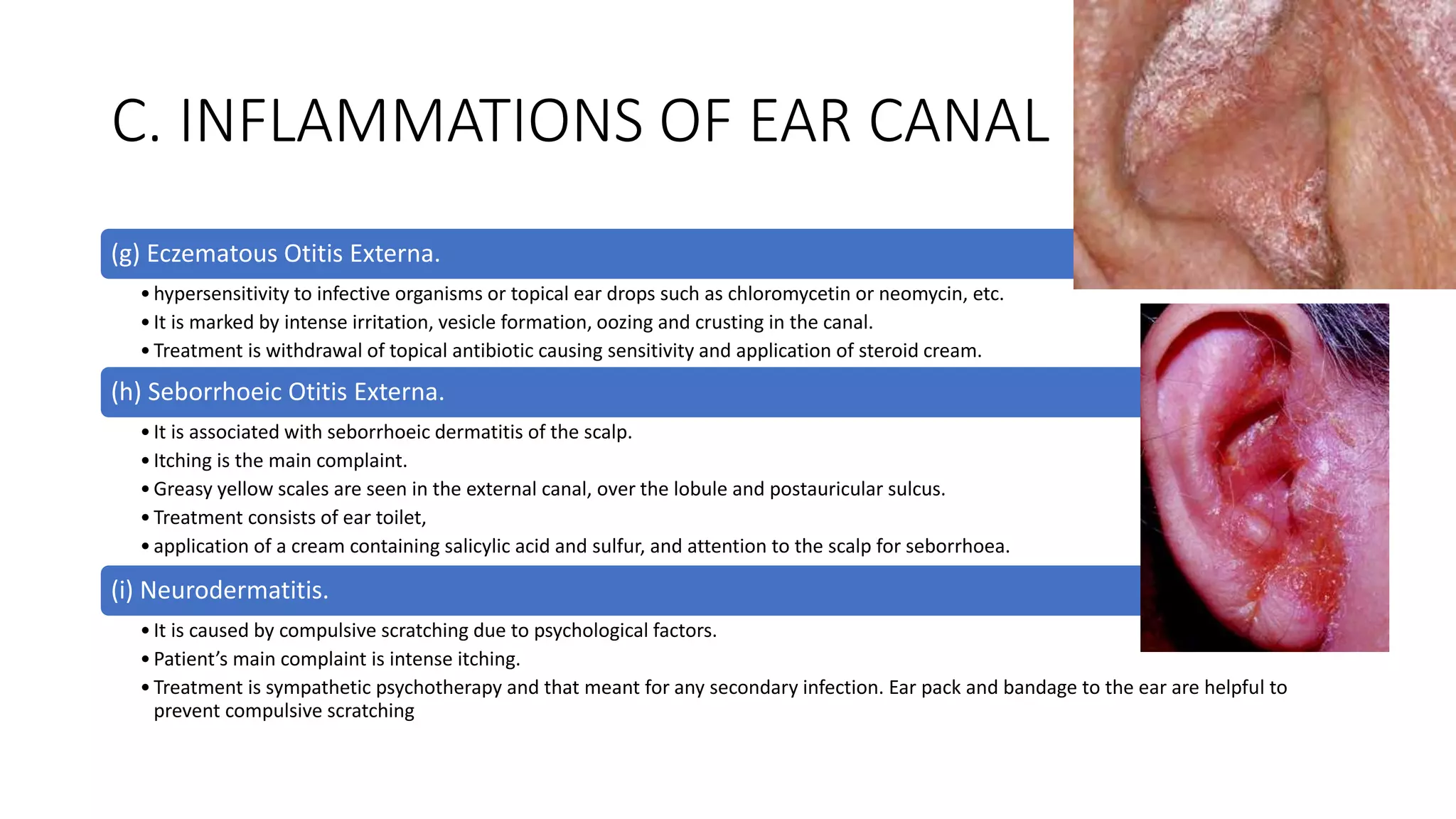 Diseases of External Ear.pptx