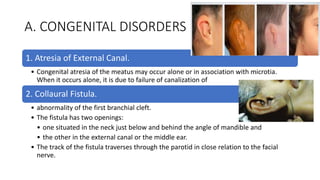Diseases of External Ear.pptx