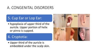 Diseases of External Ear.pptx