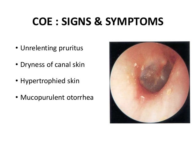 Diseases Of External Ear 1