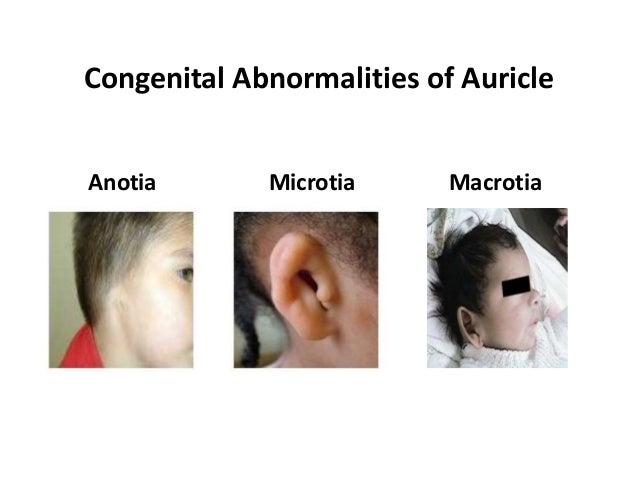 Diseases of external ear 1