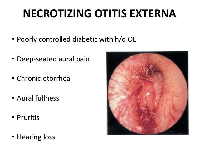 Diseases Of External Ear 1