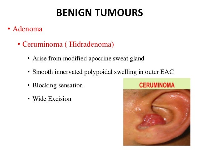Diseases Of External Ear 1