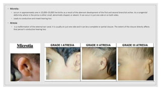 Diseases of external ear and its effect on hearinng | PPTX