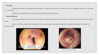 Diseases of external ear and its effect on hearinng | PPTX
