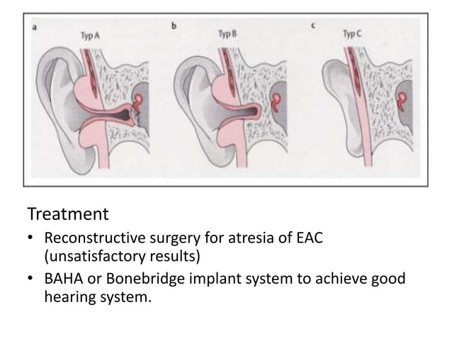 Diseases of external ear and its management | PPTX | Ear, Nose and Throat Conditions | Diseases ...
