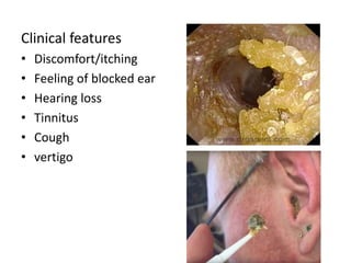 Diseases of external ear and its management | PPTX
