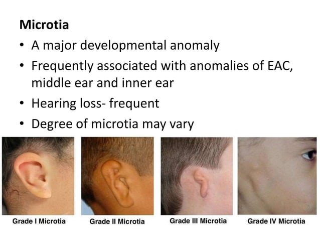 Diseases of external ear and its management | PPTX | Ear, Nose and ...