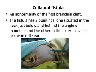 Diseases of external ear and its management | PPT