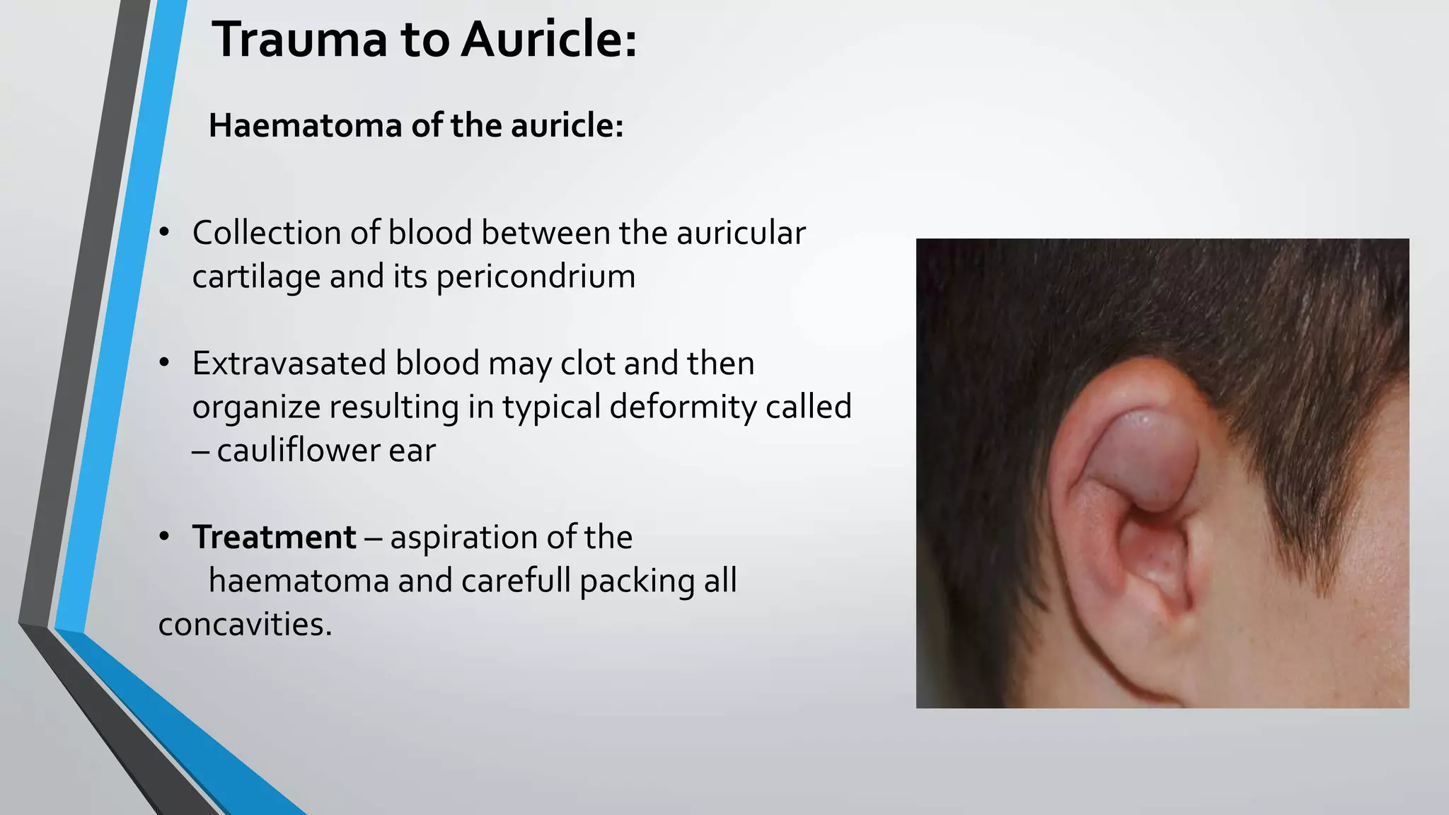 Diseases of External Ear.pptx