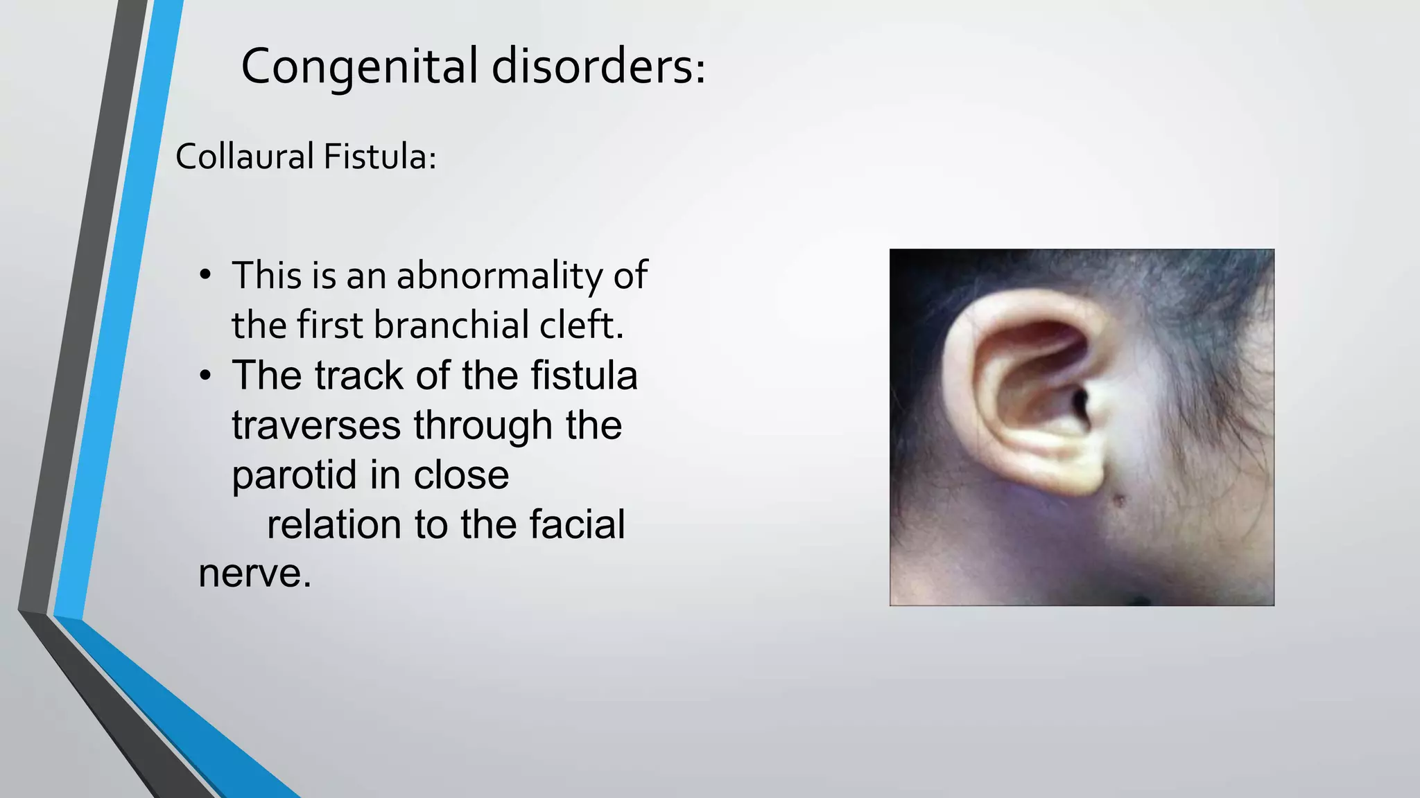 Diseases of External Ear.pptx