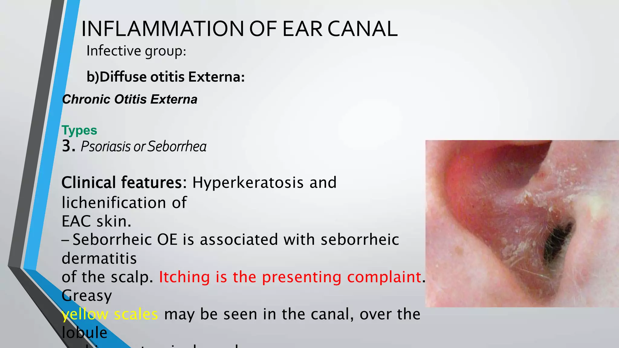Diseases of External Ear.pptx