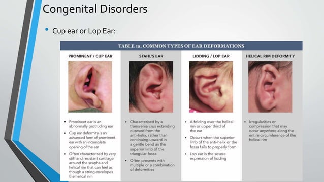Diseases of External Ear.pptx | Ear, Nose and Throat Conditions ...