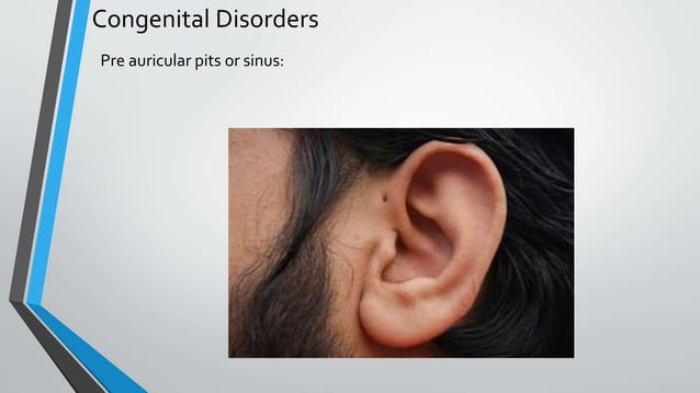 Diseases of External Ear.pptx | Ear, Nose and Throat Conditions ...