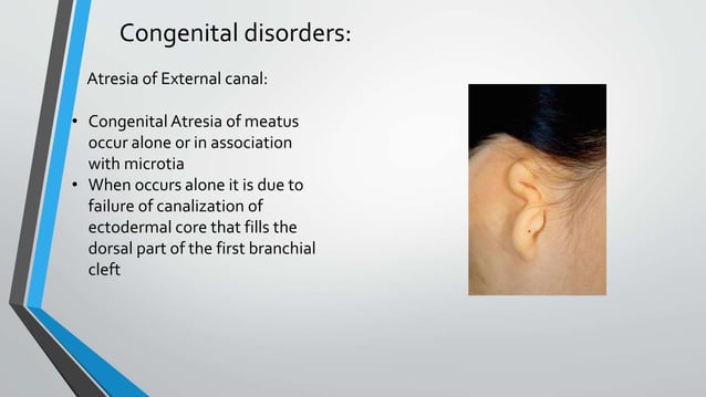Diseases of External Ear.pptx | Ear, Nose and Throat Conditions ...