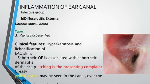 Diseases of External Ear.pptx | Ear, Nose and Throat Conditions ...