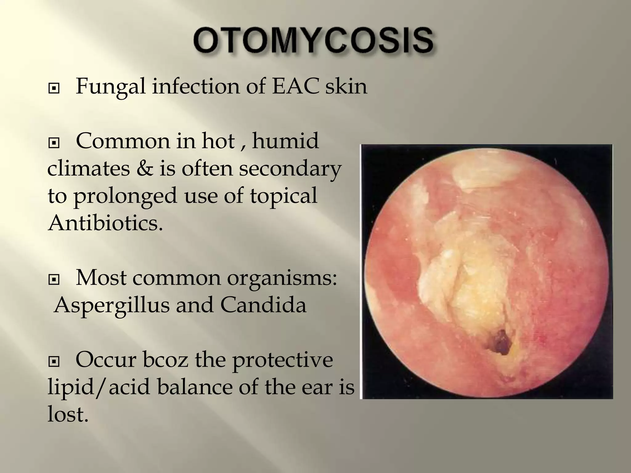 Diseases of external ear,dr.s.gopalakrishnan, 13.06.17