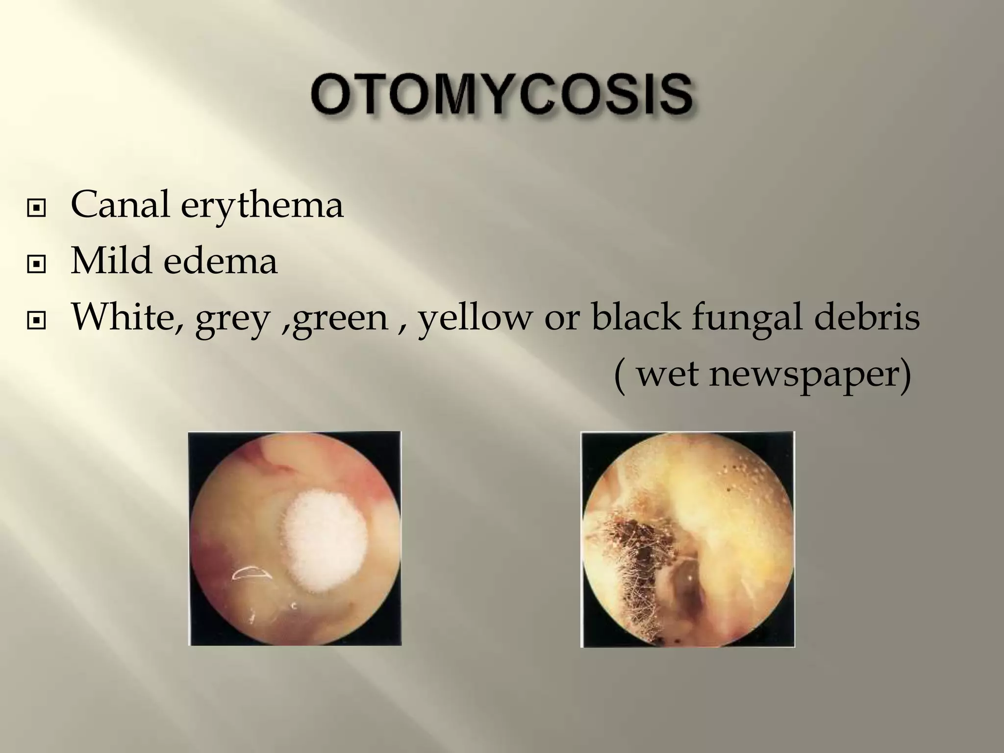 Diseases of external ear,dr.s.gopalakrishnan, 13.06.17