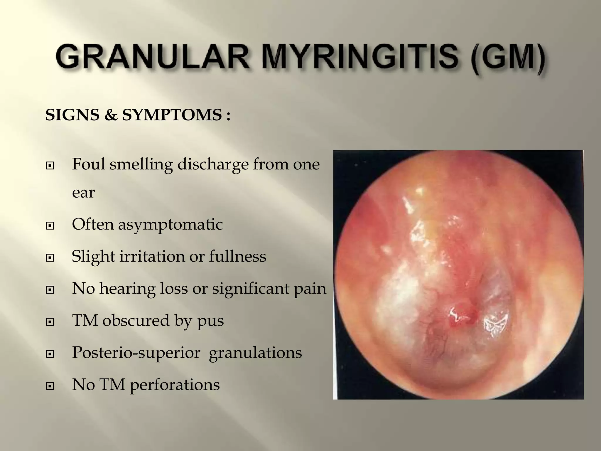 Diseases of external ear,dr.s.gopalakrishnan, 13.06.17