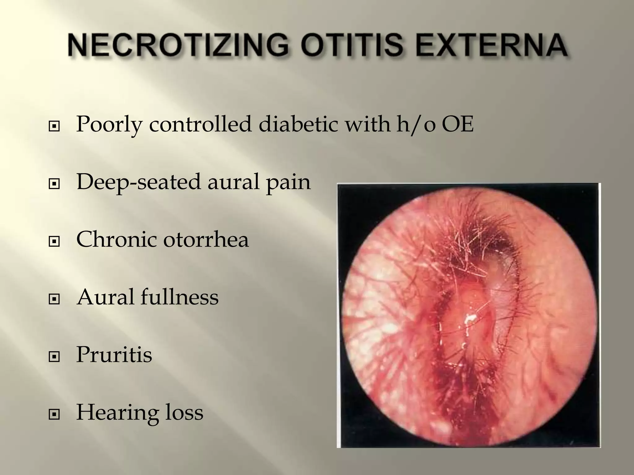 Diseases of external ear,dr.s.gopalakrishnan, 13.06.17