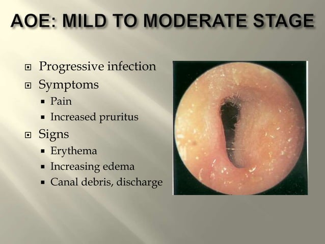 Diseases of external ear,dr.s.gopalakrishnan, 13.03.17