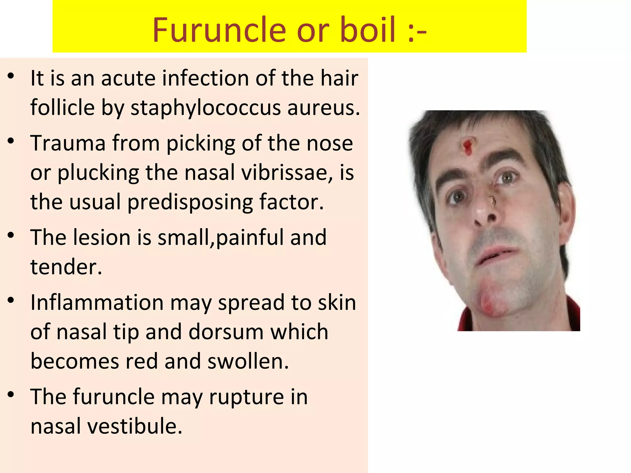 DISEASES OF EXTERNAL NOSE AND VESTIBULE BY DR.SYED REHMATHULLAH | PPT