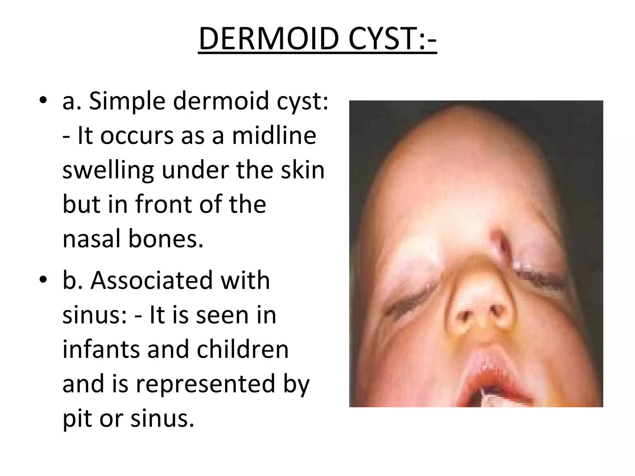 Diseases of external nose | PPT