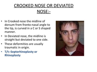 Diseases of external nose | PPT