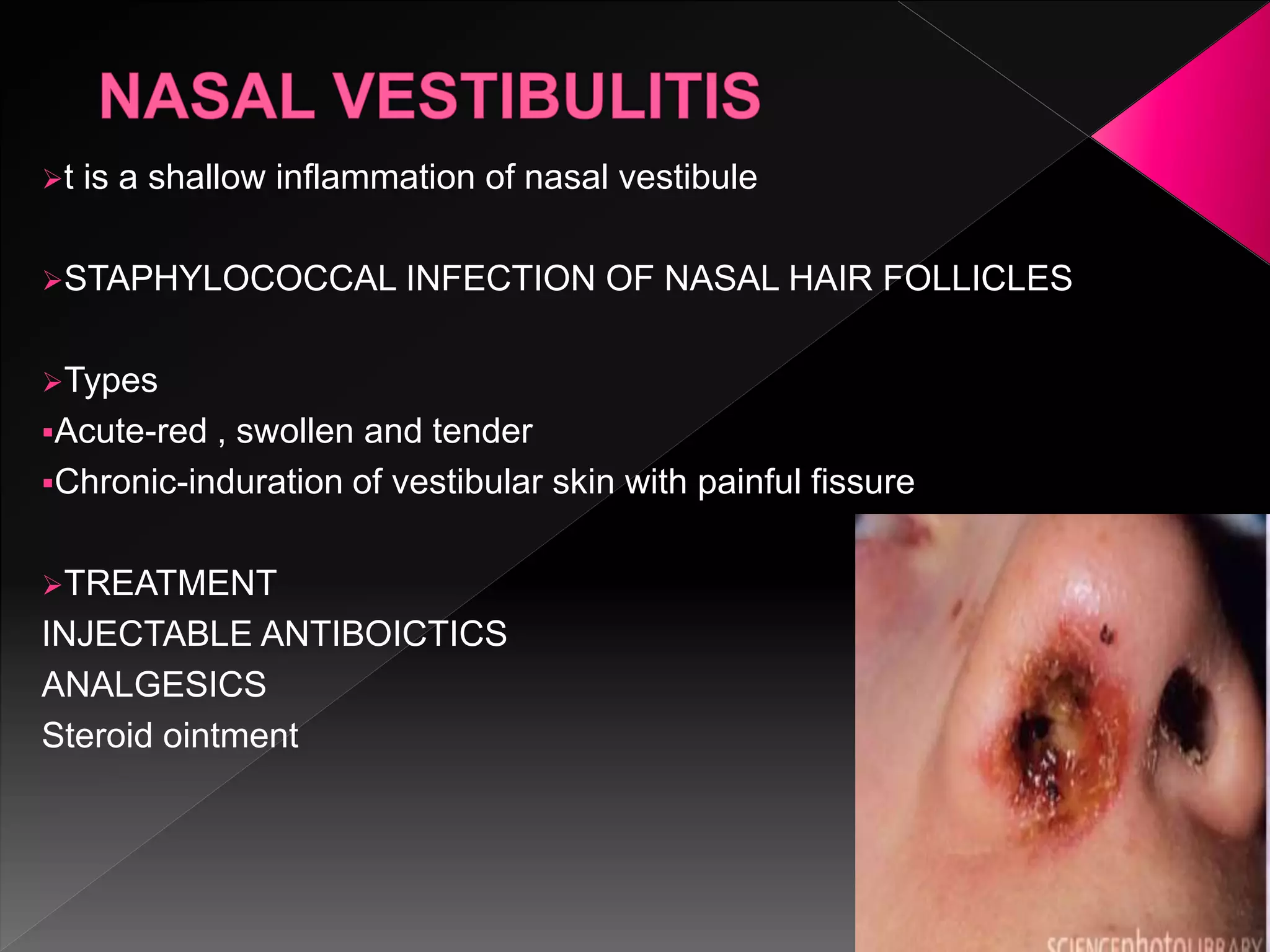 Diseases of external nose | PPTX