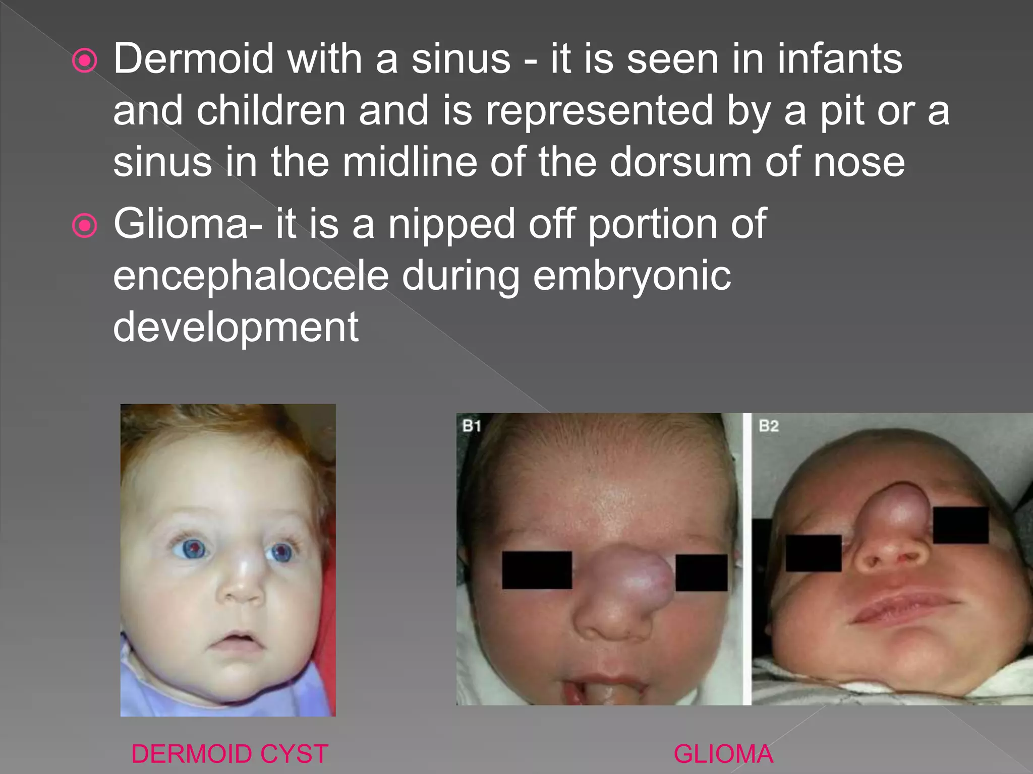 Diseases of external nose | PPTX