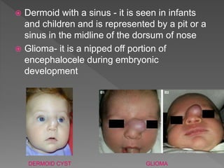 Diseases of external nose | PPTX