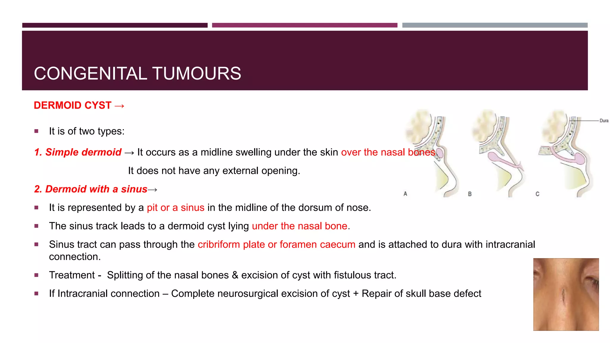 Diseases of external nose | PPTX