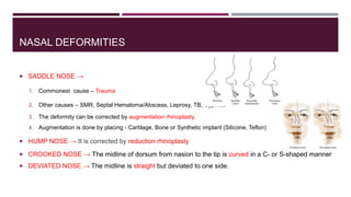 Diseases of external nose | PPTX