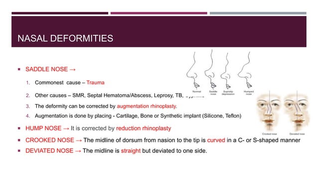 Diseases of external nose | PPT