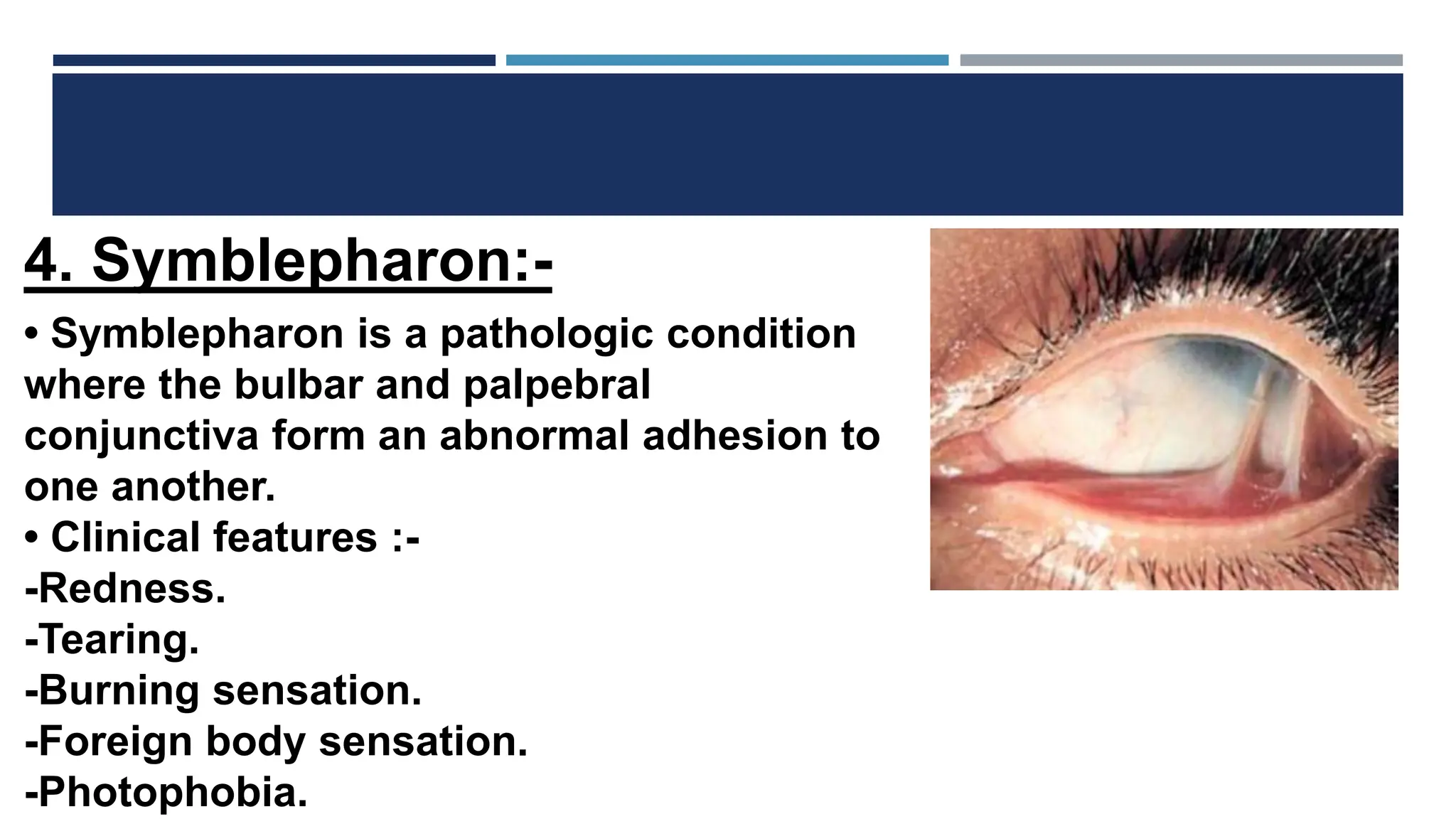 Diseases of eyelids like Epicanthus, entropian, ectropian, Telecanthus ...