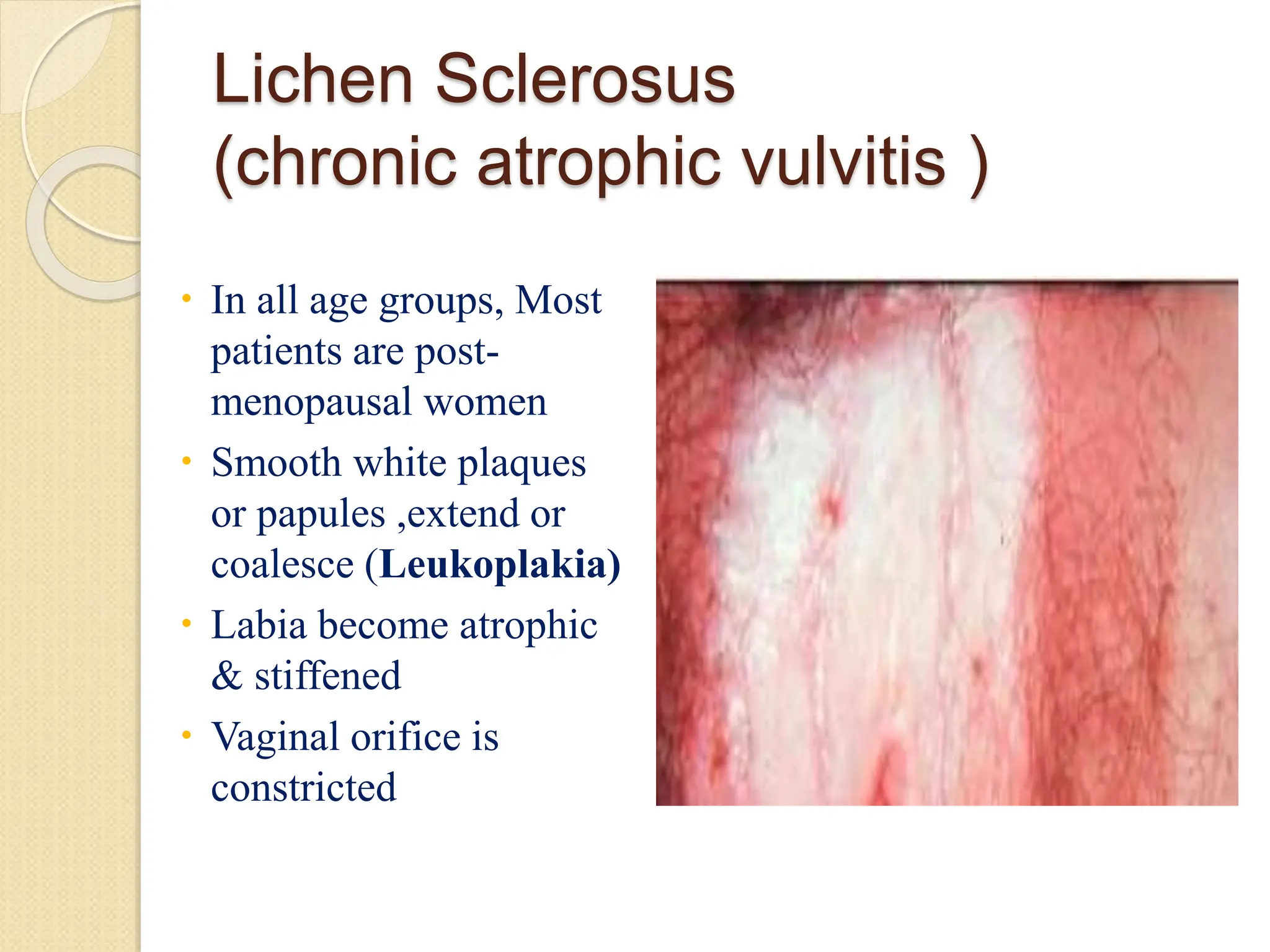 Diseases AND PATHOLOGY of Female Genital Tract1.ppt