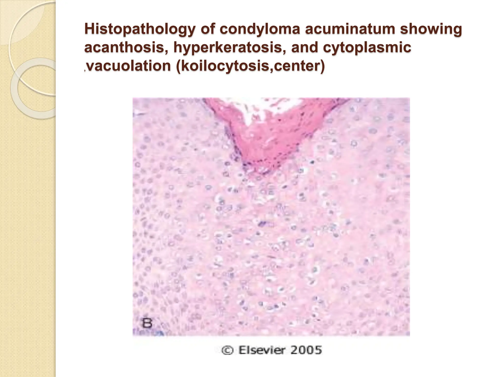 Diseases AND PATHOLOGY of Female Genital Tract1.ppt