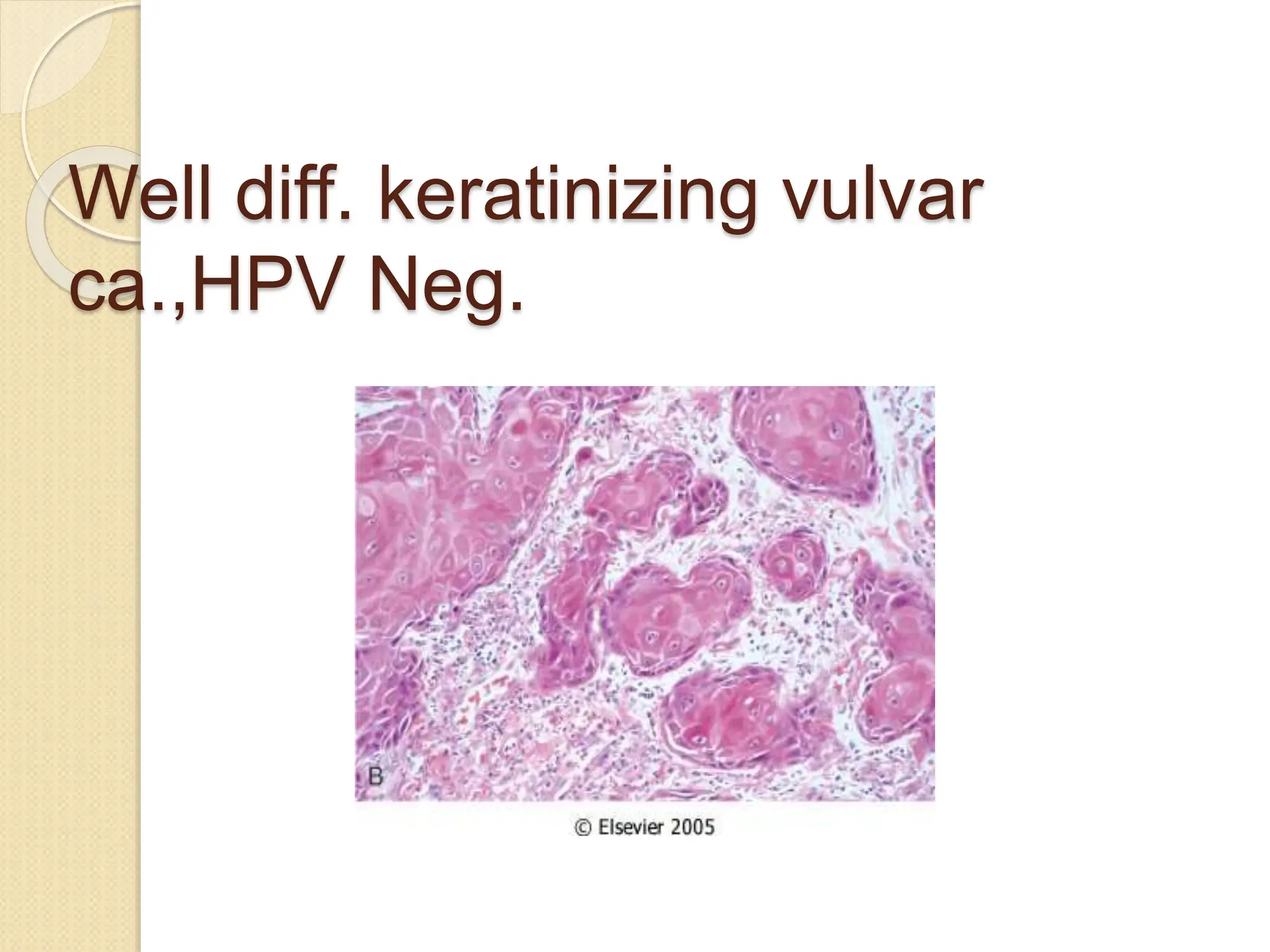 Diseases AND PATHOLOGY of Female Genital Tract1.ppt