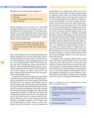 Diseases of frontal sinus | PDF