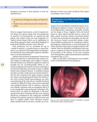 Diseases of frontal sinus | PDF