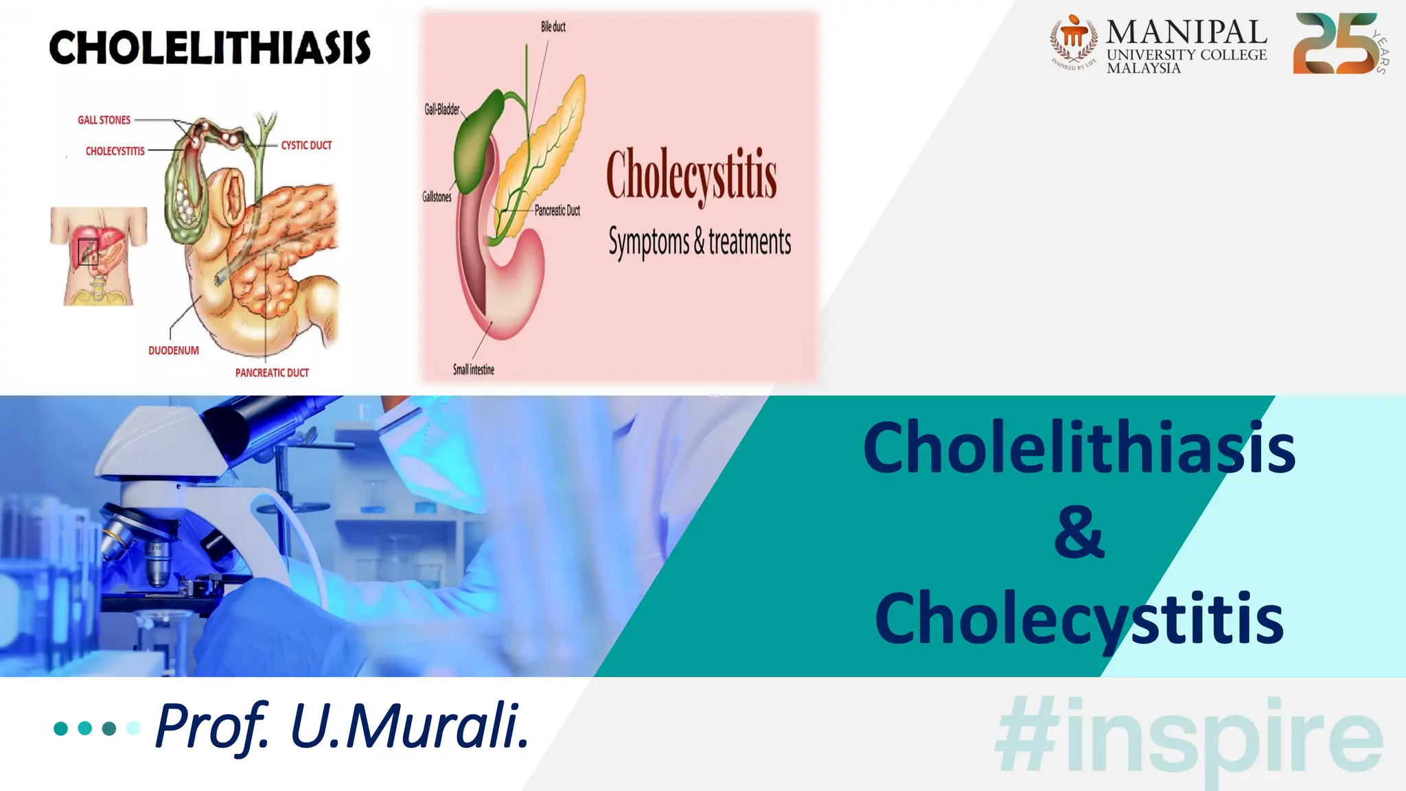 Diseases of Gallbladder - Acute Cholecystitis & Other Diseases of GB | PDF